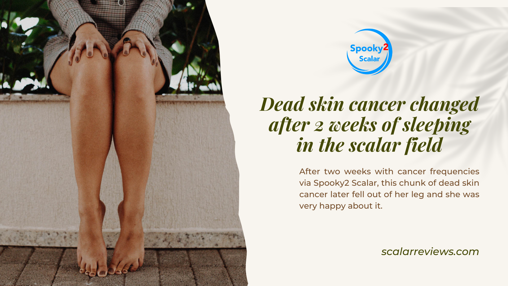 Dead skin cancer changed after 2 weeks of sleeping in the scalar field